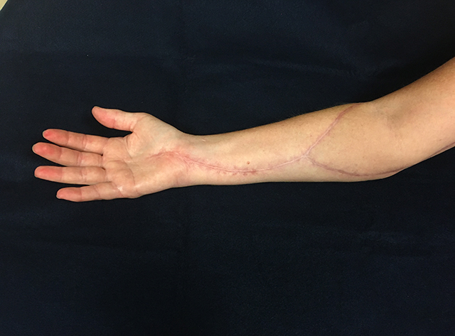Scars and The Sun - Occupational Therapy Services