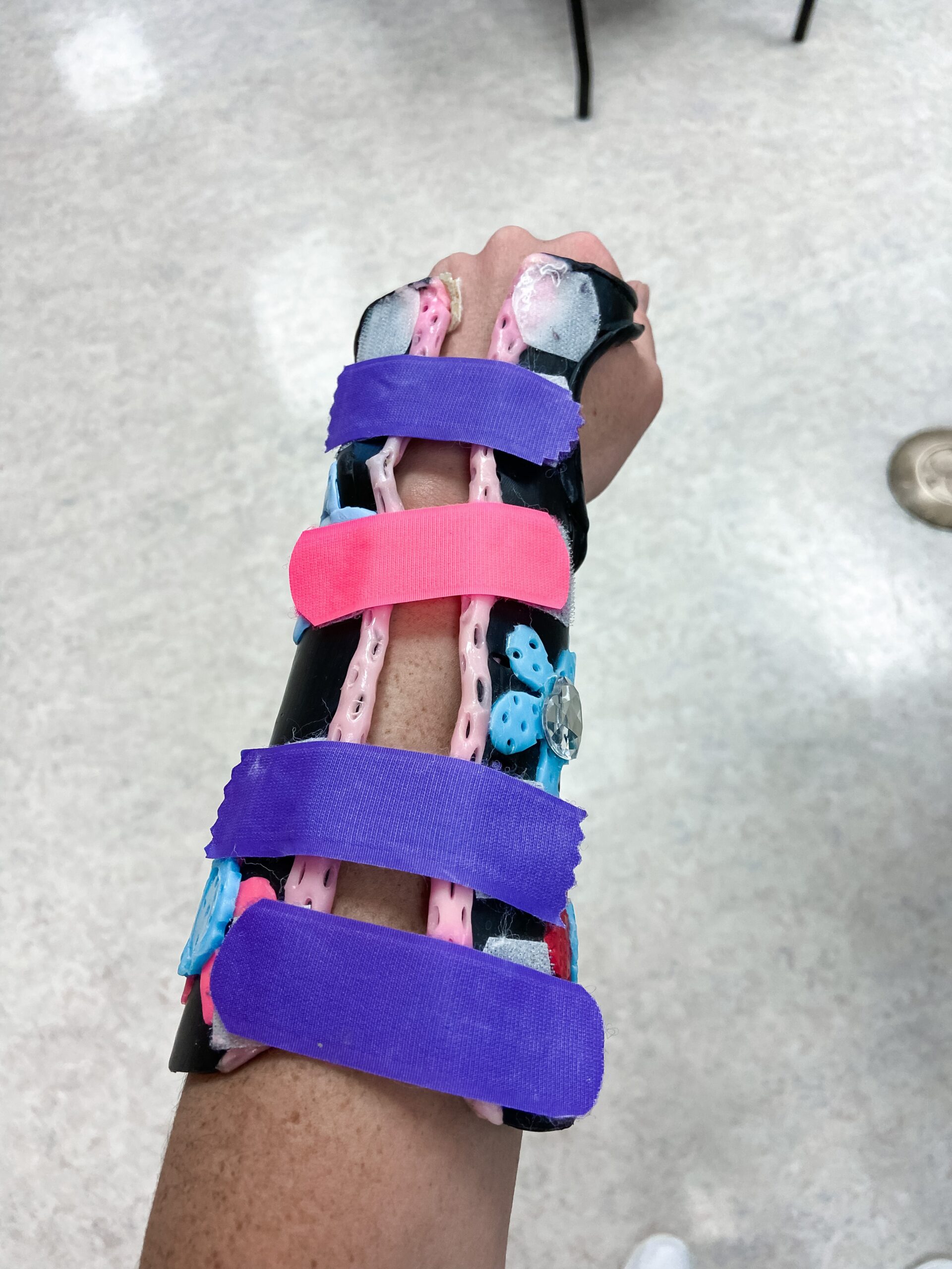 Celebrating Hand Therapy Week 2022 - Occupational Therapy Services